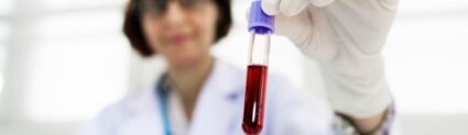 The PEth Blood Test in the Security Environment: What it is? Why it is ...